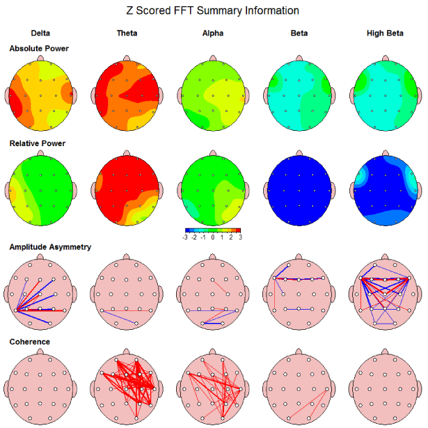 BSCIA, IQCB 정량화뇌파 QEEG BluePrint 36시간 자격 정규 과정 실시